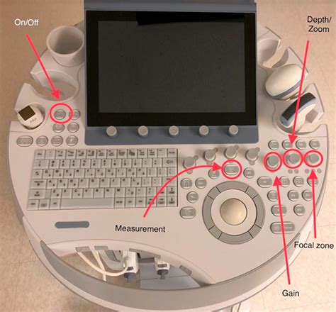 Obstetric Ultrasound Clinical Tree