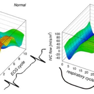 A Schematic Representation Of The TCPC Is Shown In This Example An Download Scientific