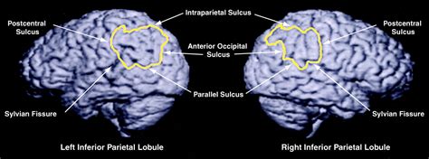Sex Differences In Inferior Parietal Lobule Volume In Schizophrenia American Journal Of Psychiatry
