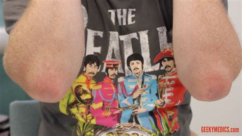 Hand Wrist Examination Osce Guide Geeky Medics