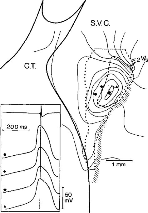 Structure Of Crista Terminalis Cordis Semantic Scholar