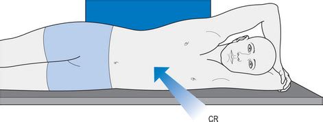 Radiological Examination Of Women Of Reproductive Capacity Radiology Key