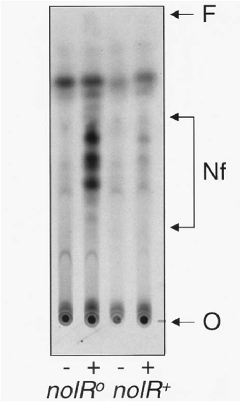 Thin Layer Chromatography Tlc Analysis Of In Vivo Radioactively