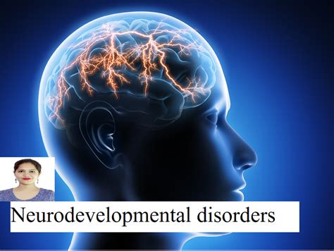 What Is Neurodevelopmental Disorders Treatment Of Neurodevelopmental