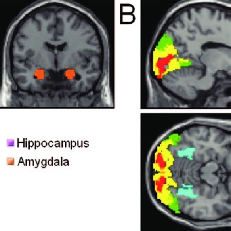 The Seeds Of Interest SOIs Used In Connectivity Analysis Appear On Download Scientific