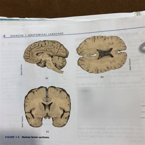 Human Brain Sections Diagram Quizlet