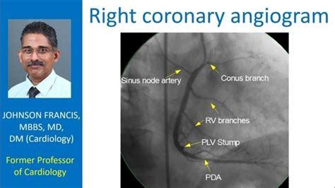 Angiogram Flashcards Quizlet