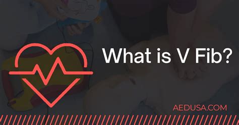 What Is V Fib