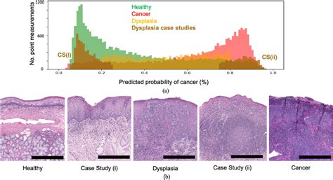 Figure 1 From Intraoperative Margin Assessment In Oral And