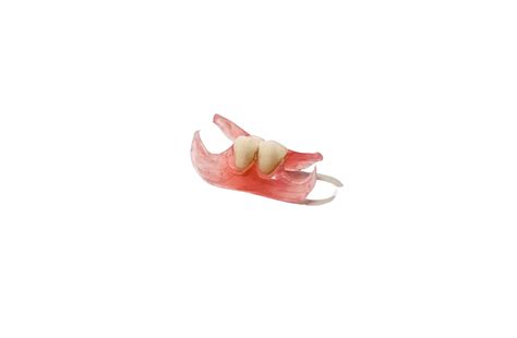 Unilateral Partial Denture Revived Smiles