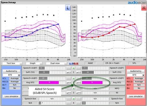 speech intelligibility index chart ponasa