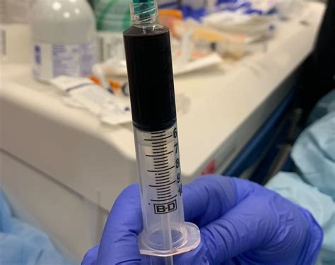 Fatal Methaemoglobinemia Due To Intentional Sodium Nitrite Ingestion Bmj Case Reports