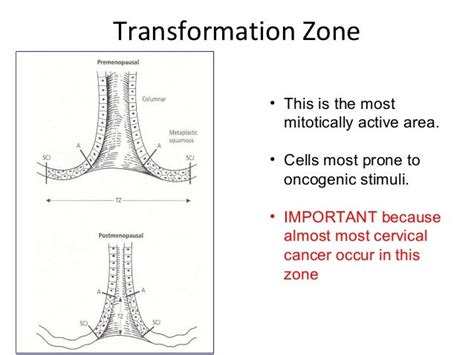 Cervix Transformation Zone Histology