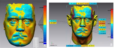 Superimposition Of The Two Scans And The Color Coded Heat Maps