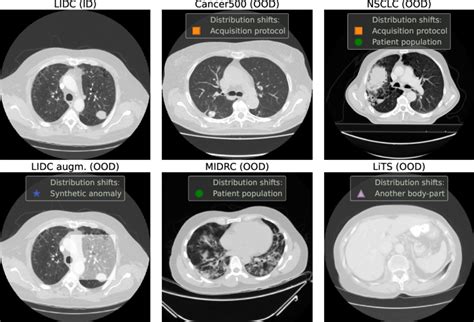 Examples Of Ct Images Representative Axial Slices From Different Download Scientific Diagram
