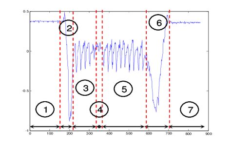 X Axis Accelerometer During An Up And Go 1 Sitting 2 Standing Download Scientific