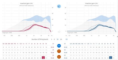 Comparing Widex Smartric To Philips 9040 Hearing Aids Hearing Aid