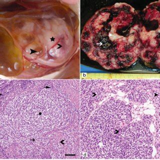 Sex Cord Stromal Tumour In The Ovary Of Koi Cyprinus Carpio Koi A B Download Scientific