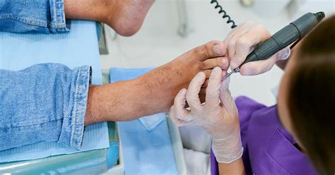 Medical Pedicure Procedure Benefits Risks And More