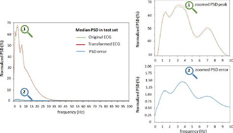 Figure 1 From Application Of Convolutional Neural Network For Decoding Of 12 Lead