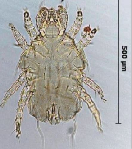 Ectoparasites Flashcards Quizlet