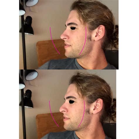 Are These Results For Rhino Realistic Bottom Is Current Scrolller