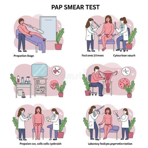 Illustration Depicting The Pap Smear Test Process In Six Stages Each