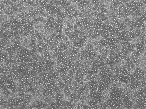 Primary Hepatocytes Human Hepatocytes AXOL Bioscience