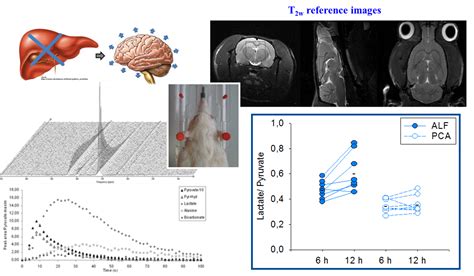 Transgenic Mouse Model Of Schizophrenia Sermn Nmr Service At Uab
