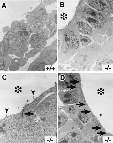 Apical Basal Polarity And Adhesive Junctions In The Sna Ϫ Ϫ Mutant