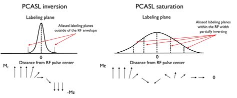 Figure 1 Illustration Of The Proposed Method For Flowing Spins Saturation Using Pcasl