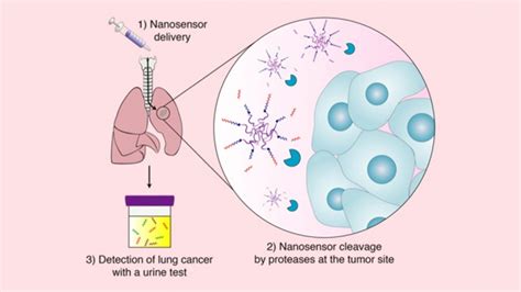 Lung Tumors Sensors Could Offer Early Detection Syntec Optics
