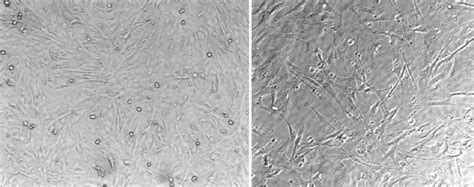 Culture Of Primary Mouse Embryonic Fibroblasts Creative Bioarray