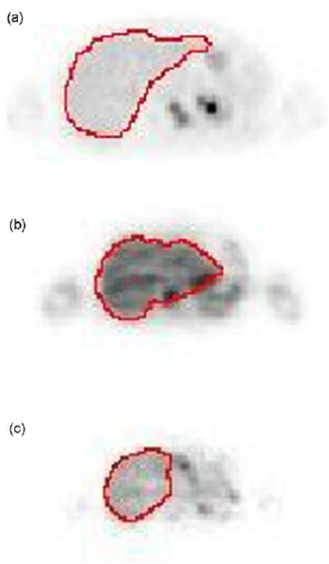 The Shape And Location Of The Initial Curve A Obtained From Result Of