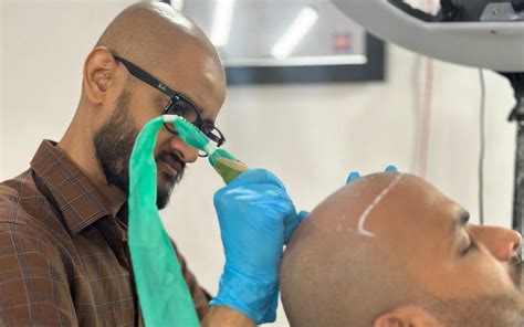 Scalp Micropigmentation Process And Procedure A Complete Guide