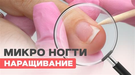 Наращивание на мини ногти трамплины | Онихолизис - YouTube