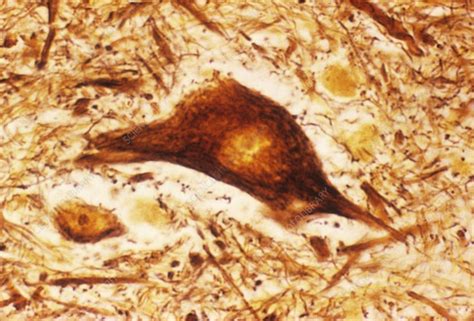 Spinal Cord Neurone Light Micrograph Stock Image C023 5968 Science Photo Library