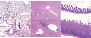 Rna Binding Proteins Found Essential For Regulatory T Cell Function And