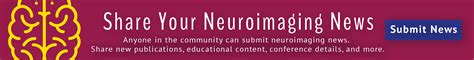 NITRC NIRS KIT A MATLAB Toolbox For Both Task And Resting State FNIRS Data Analysis Tool