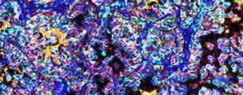 Advancing Cellular Research Through Multiplex Immunohistochemistry News News And Events