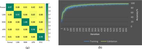 figure 1 from ecg classification using higher order spectral estimation