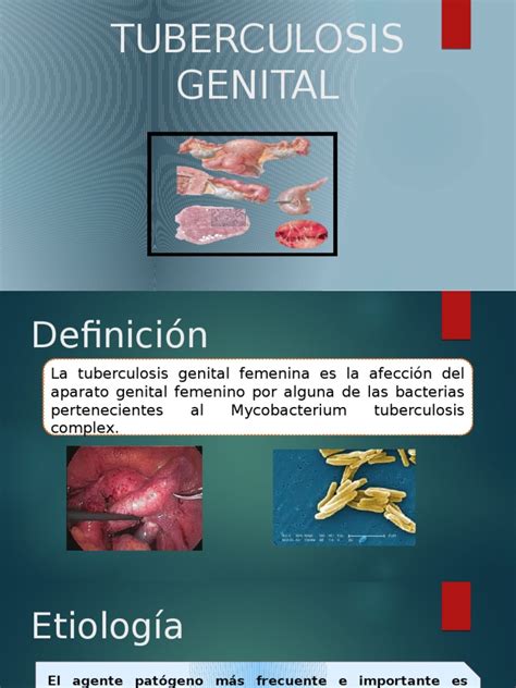 Tuberculosis Genital Pdf Tuberculosis Vagina
