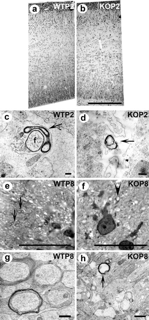 Myelination In The Cerebral Cortex Of The Wt And Tnap Ko Mice Of Download Scientific Diagram