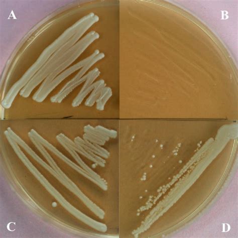 Functional Complementation For The Growth Of The Yeast Strain Ysc6274 Download Scientific