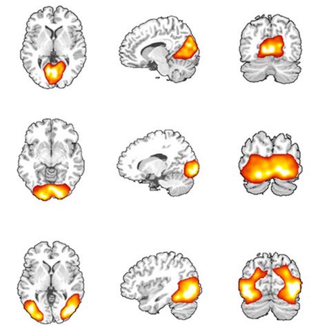 Topography Of Visual Networks Estimated From The Resting State Fmri Download Scientific Diagram