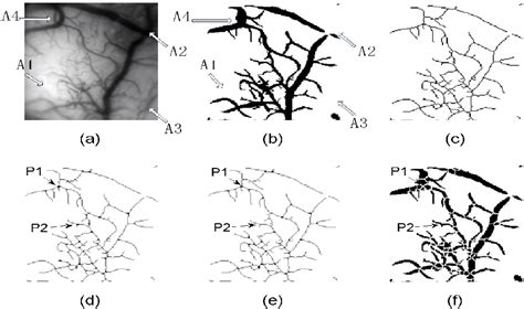 Figure 2 From Separation Of Arteries And Veins From Optical Imaging Of Intrinsic Signals Using