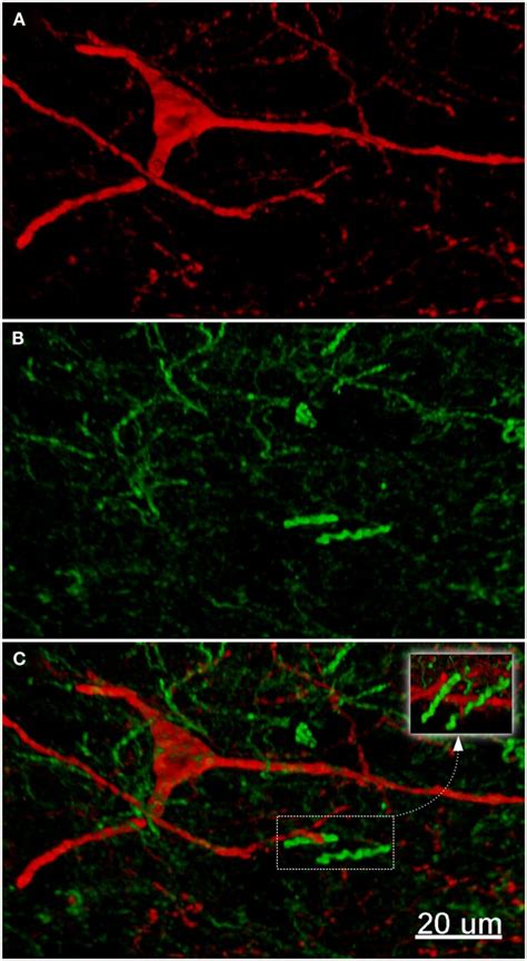 The Fluorescence Pattern In A Double Stained Section Of The Nucleus