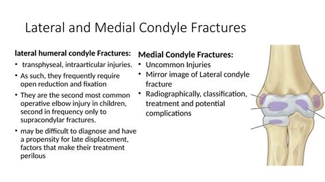 Lateral And Medial Humeral Condyle Fracturespptx