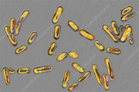 Clostridioides Difficile Light Micrograph Stock Image C033 2989 Science Photo Library