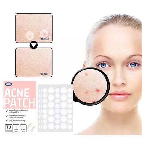 Invisible Acne Patches Hydrocolloid Spot Treatment And Repair Thegivenget